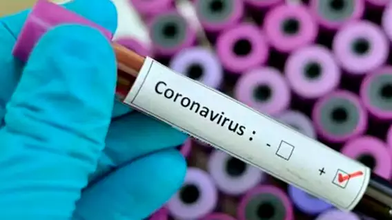 Coronavirus wuxuu waxyeelo weyn u geystay warshadaha dalxiiska adduunka